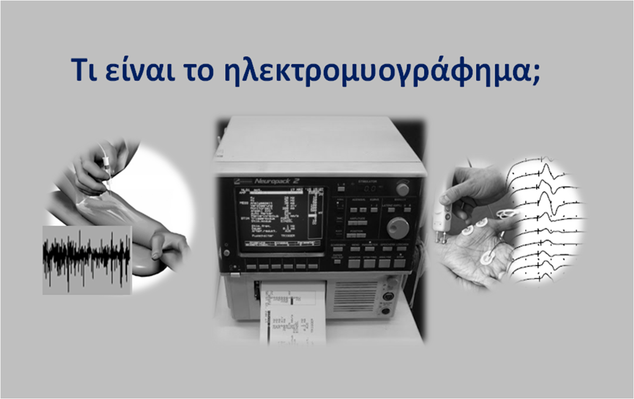 Τι είναι το ηλεκτρομυογράφημα - e-neurologos.gr